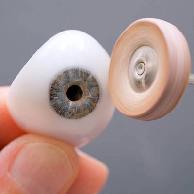 Mat. Quirúrgico Y Prótesis Oculares | Saracco